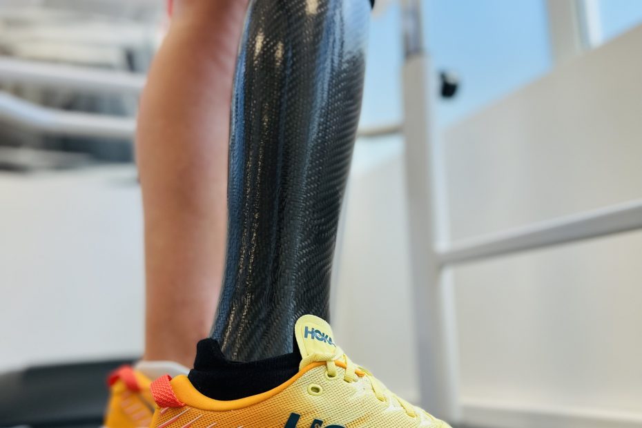 Prothèse pour membre amputé à Toulouse | Ortho-Evolution