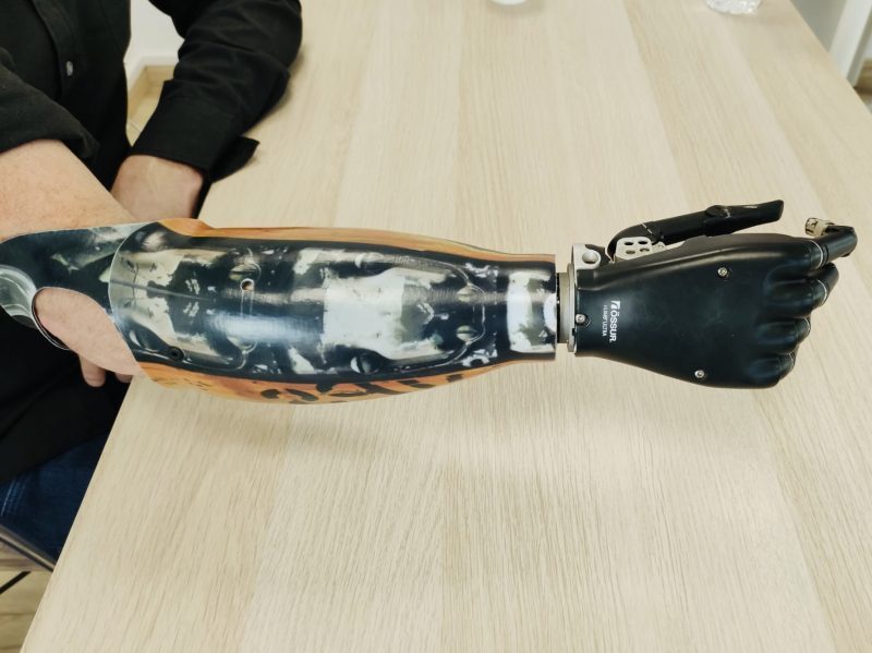 Découvrez nos Nouvelles prothèses et essais | Ortho-Evolution