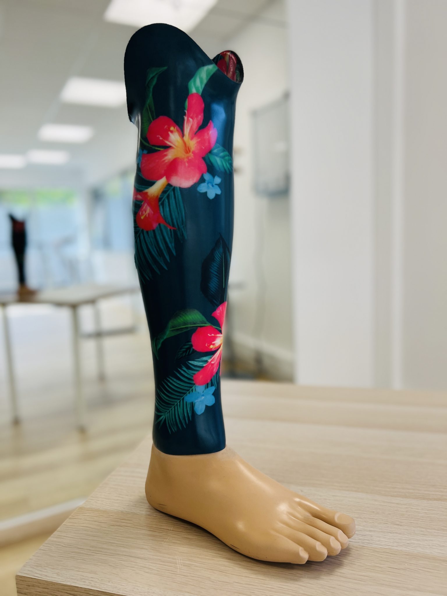 Prothèse tibiale amputation à Toulouse | Ortho-Evolution